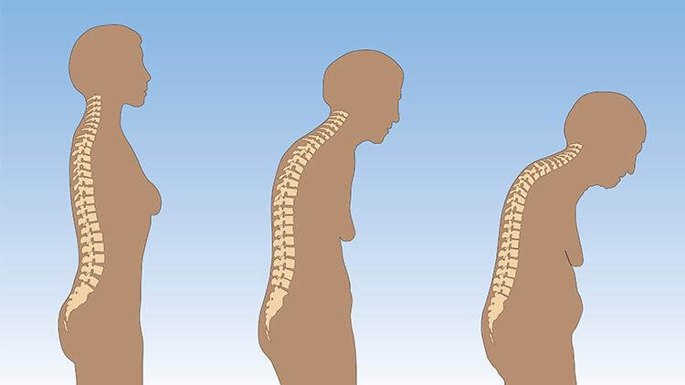 Bechterew - Chiropraxie Zaffelare - Pierre Mercier